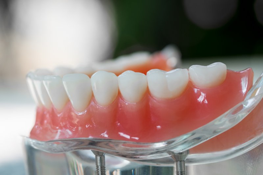 The Evolution of Dentures | Nova Smile Dental